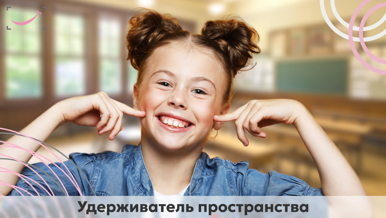 Удерживатель пространства (кольцо-петля): цена в Москве | Сеть ...